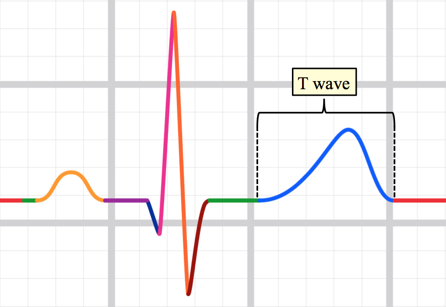 Teaching Medicine - Tutorial: Analyze the Waveforms